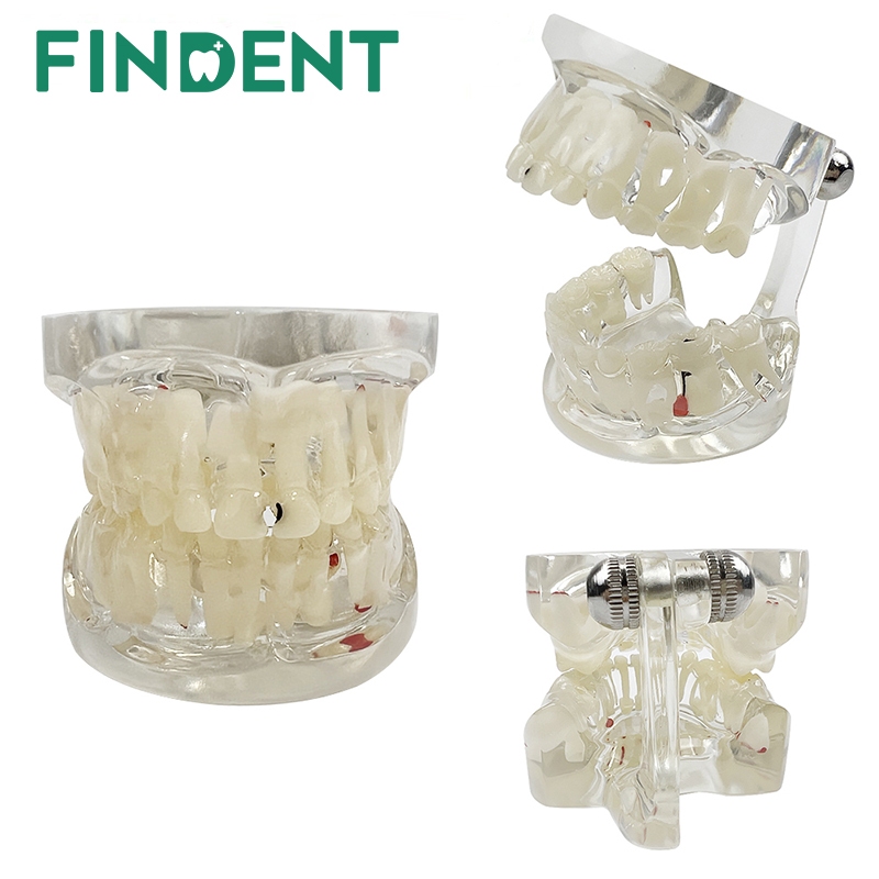 Dental Teaching Model Child Primary Teeth Mixed Dentition Model With ...
