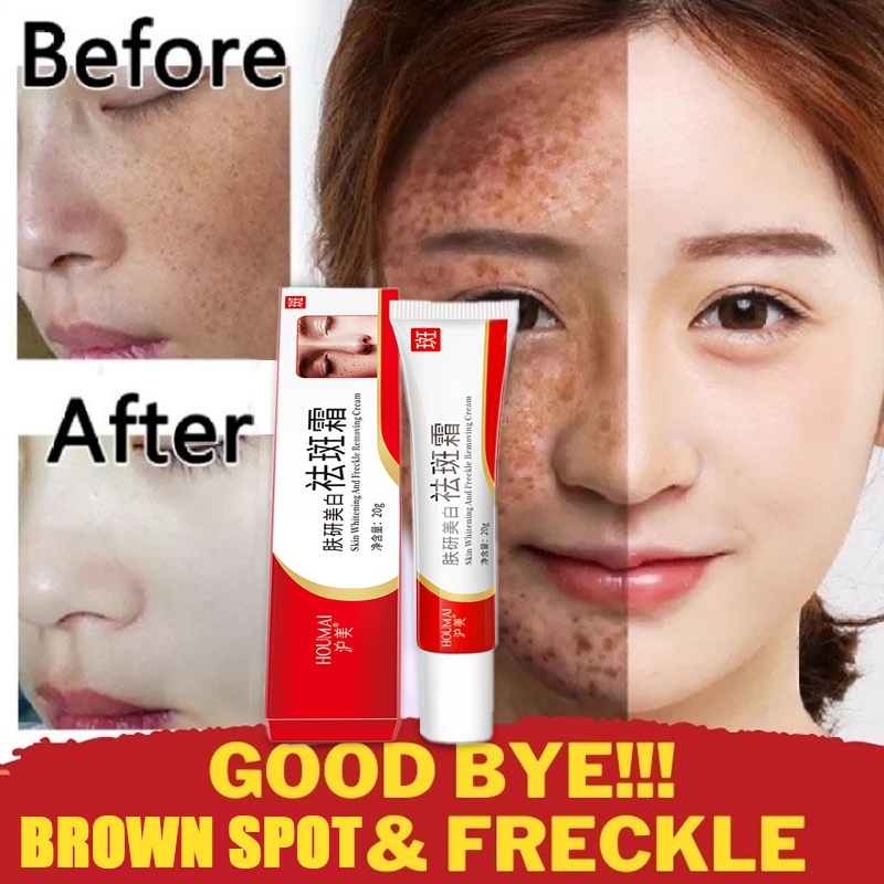 100% Original Freckle removal cream to remove chloasma cream lighten ...