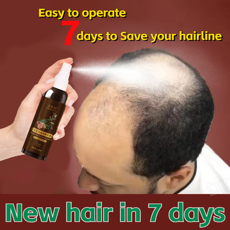 Hair growth serum, anti hair loss tonic, hair growth spray 100ml Hair ...