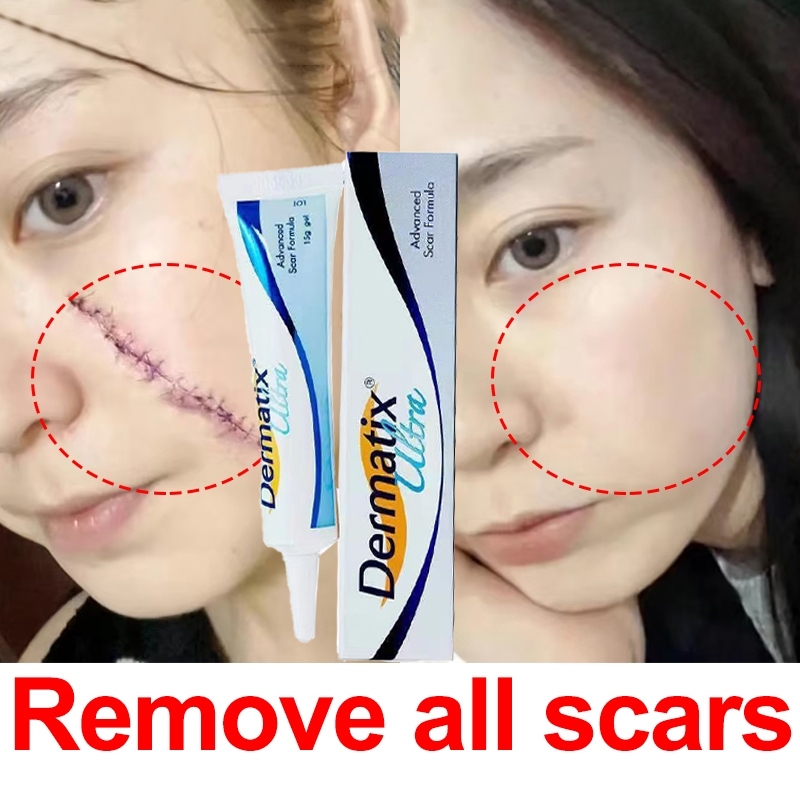 Skin Repair Skin Care Acne acne scar advance gel scar formula 15g ...