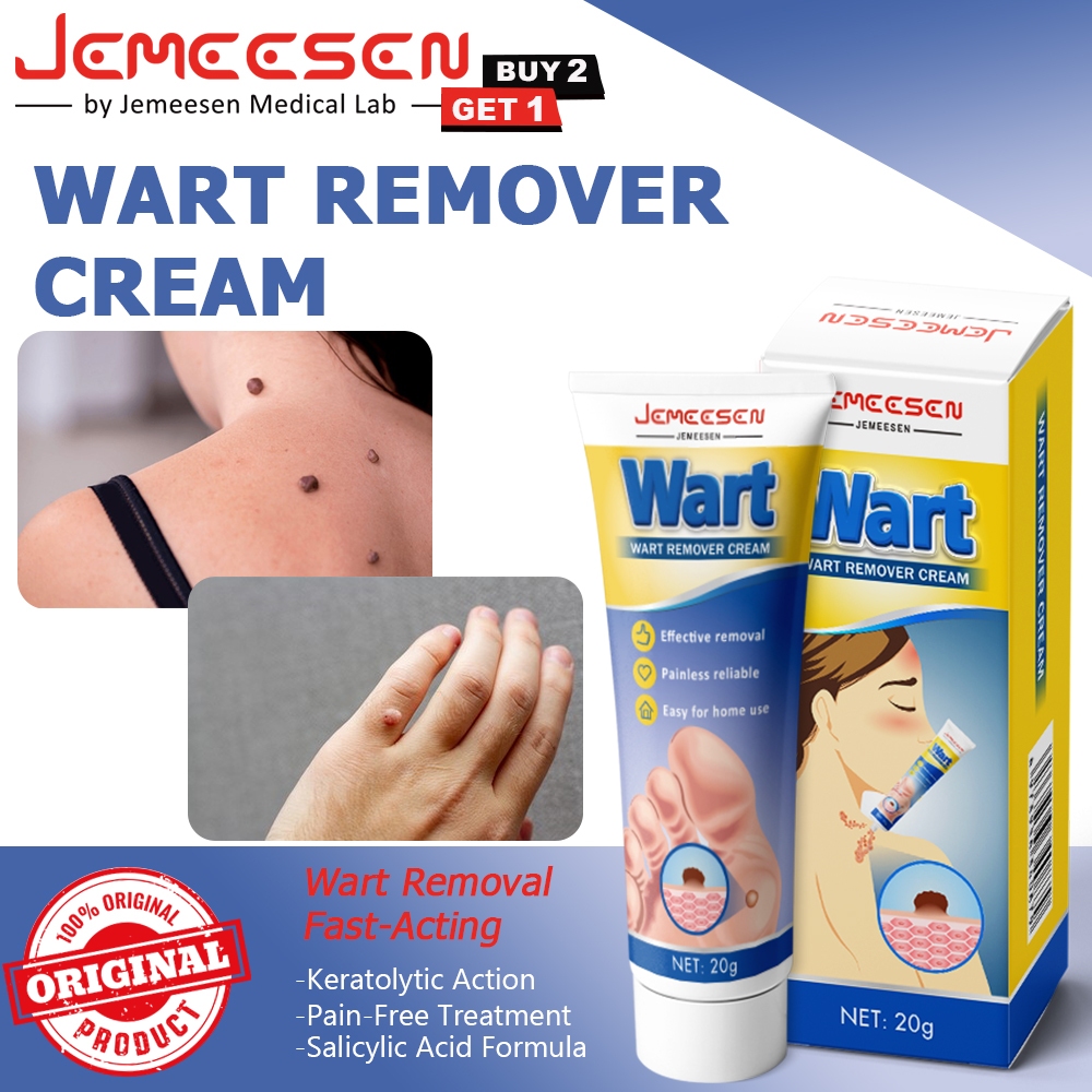 Jemeesen Wart Removal Cream Eliminate Warts Restore Smooth Skin Gentle ...