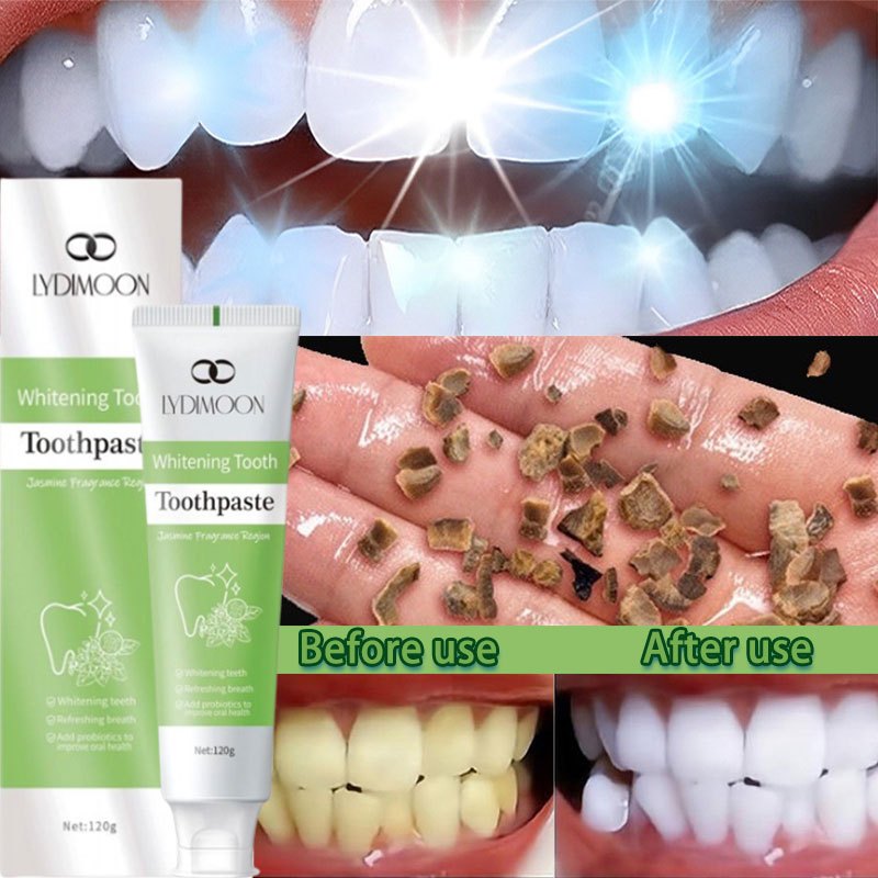 Whitening toothpaste to remove dental calculus,yellowing, bad breath ...