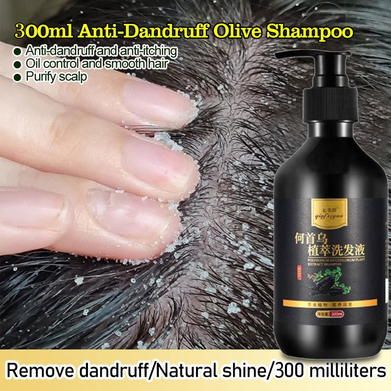 Dandruff Shampoo Polygonum multiflorum shampoo Oil Control Shampoo ...