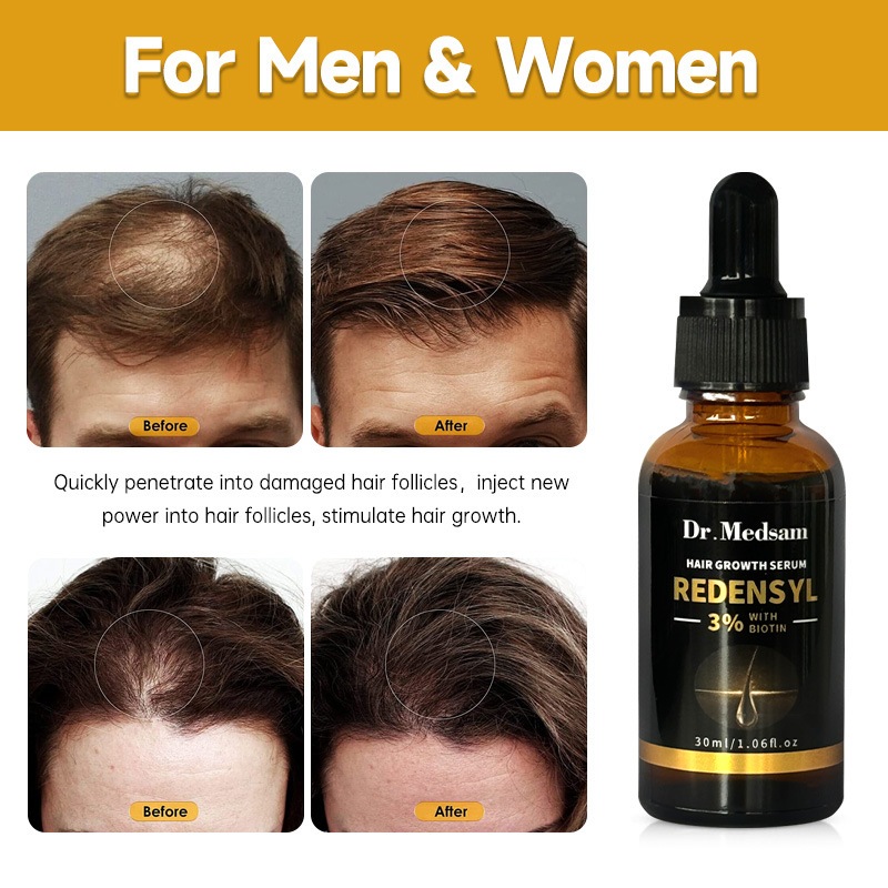 Dr.Medsam Hair Regrowth Treatment Serum, REDENSYL 3% with Biotin , Anti ...