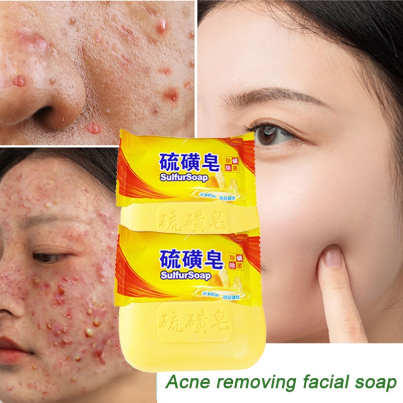 Sulfur Soap 硫磺皂 Effective Solution for Skin Issues like Acne, Psoriasis ...