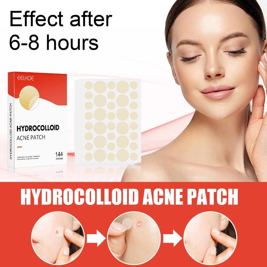 Local Stock>Hydrocolloid patch Acne patch Hydrocolloid Hydrocolloid ...