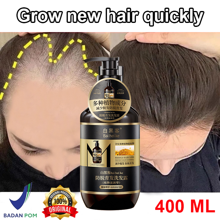 shampoo hair anti hair loss shampoo shampoo untuk rambut gugur shampoo ...