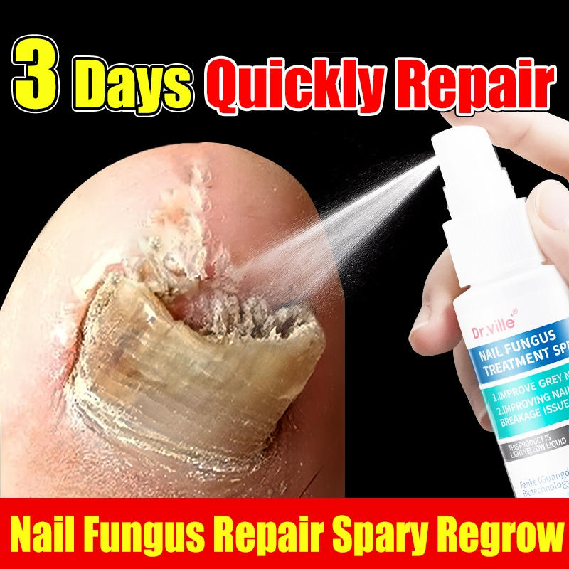 Japan Nail Fungal Treatment For Nail Care Antiseptic Spray Clear ...