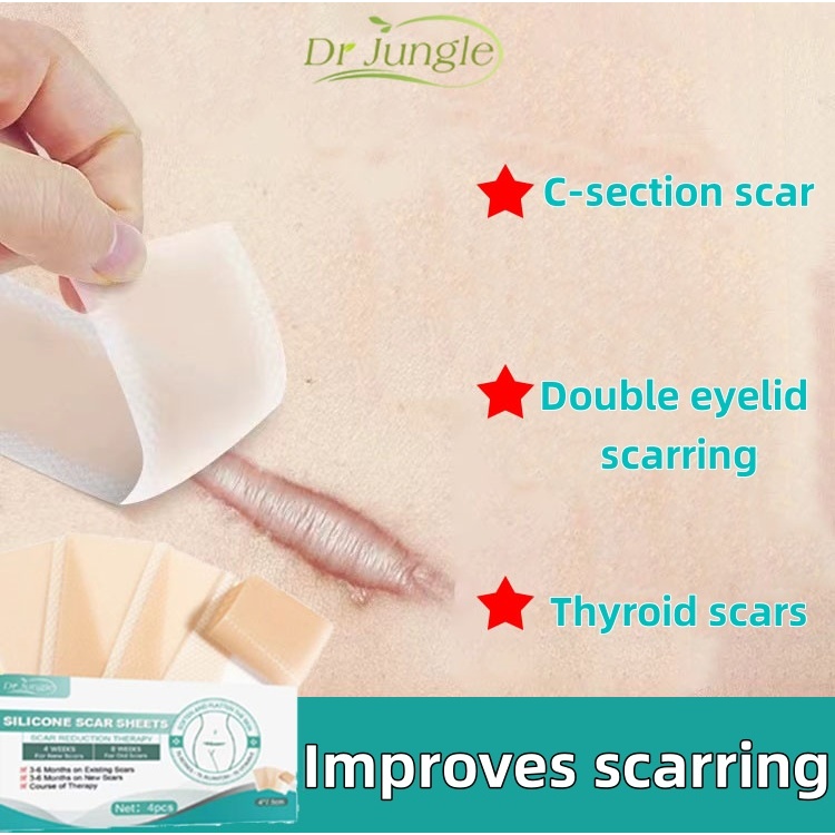 【Genuine】dr jungle Scar patch for caesarean section children's scar ...