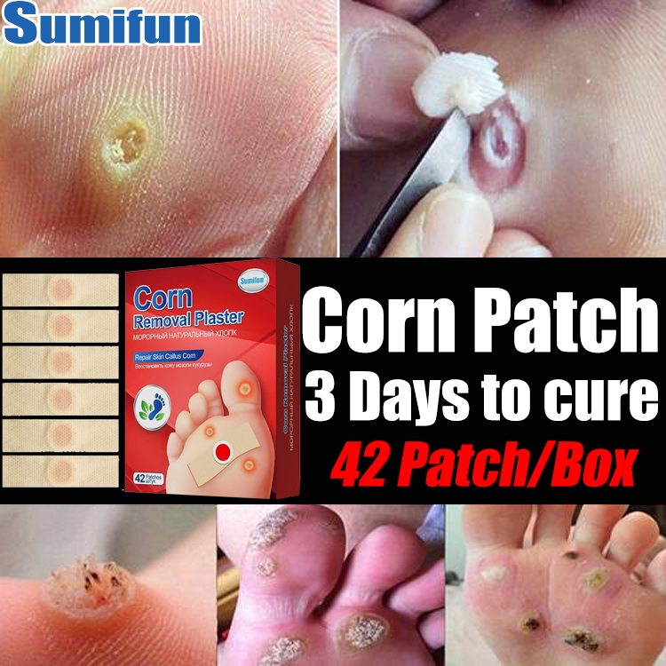 Wart Painless shedding Corn Remover (42 Patches Per Box) Corn Caps ...