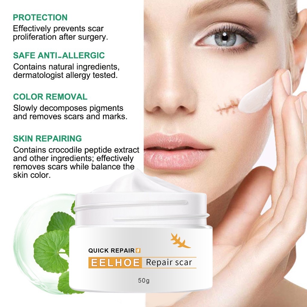Scar Remover Cream Acne Treatment Pimple Scar Removal for Old Scars ...