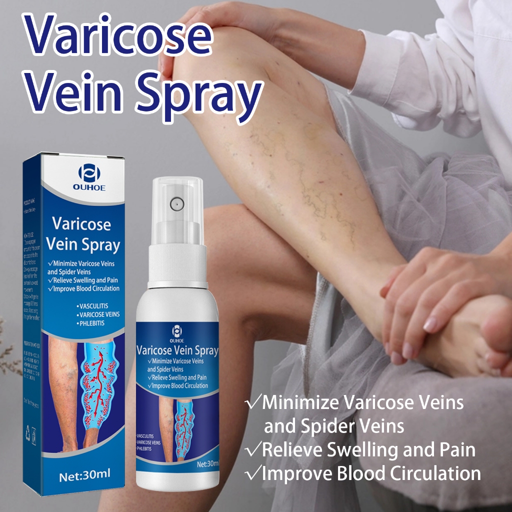 Local Stock>Vein massage spray Vasculitis relief Phlebitis Bulging ...