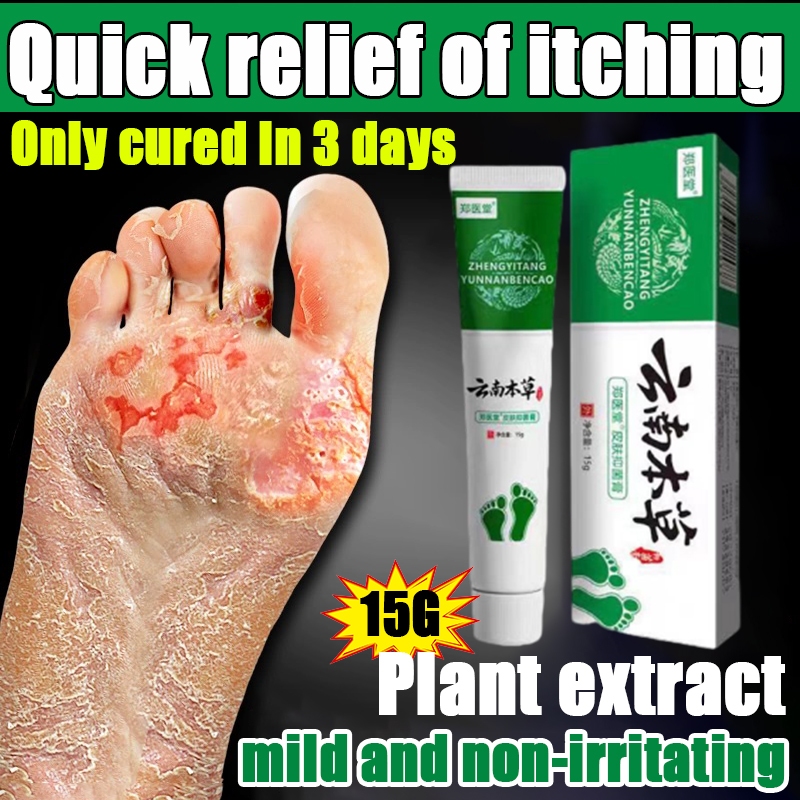 Quick relief of itching Ubat kulat air kaki Only cured athlete's foot ...