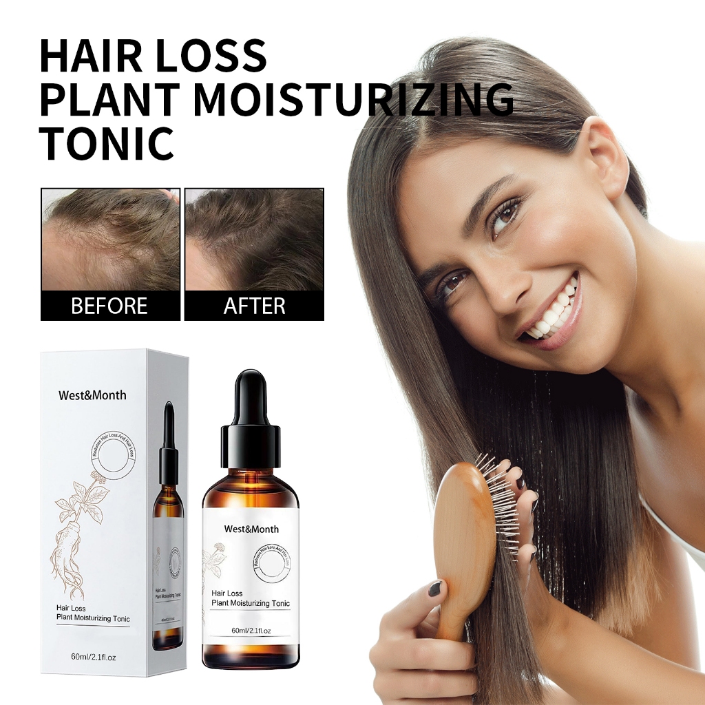 Local Stock>Hair growth oil 60ml Hair loss treatment, baldness ...