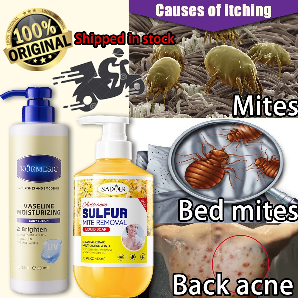 Shower Gel Anti-mite Dust mite body wash Natural bed bug and dust mite ...