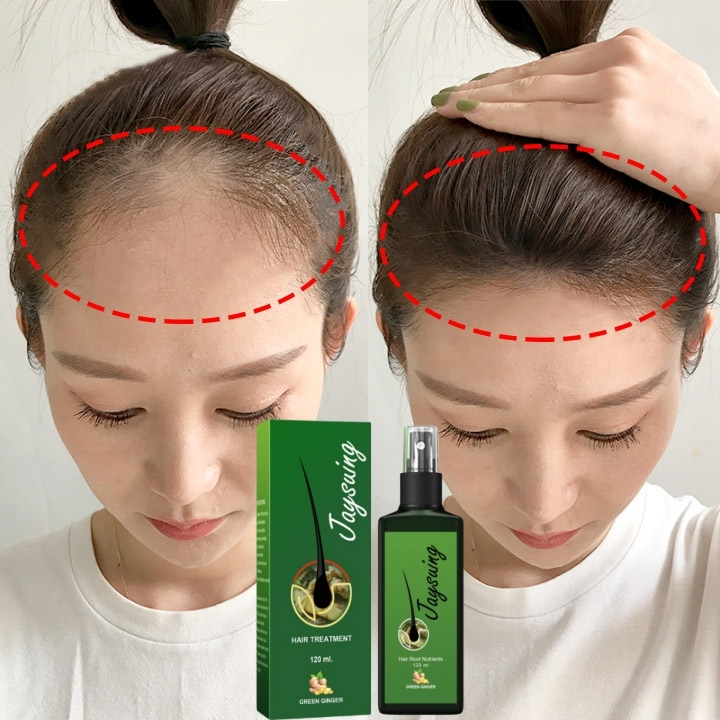 Hair Growth Spray Hair Tonic Growth anti Hair Loss Treatment pelebat ...