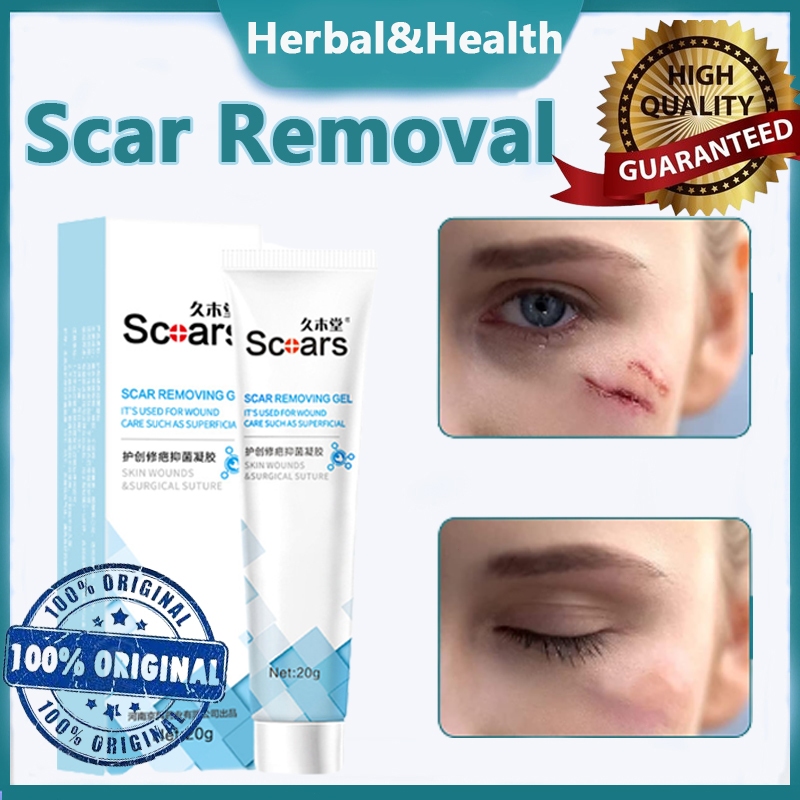 Scar Removal Cream Obat Atasi Keloid Hyperplasia Scar Repair Gel ...