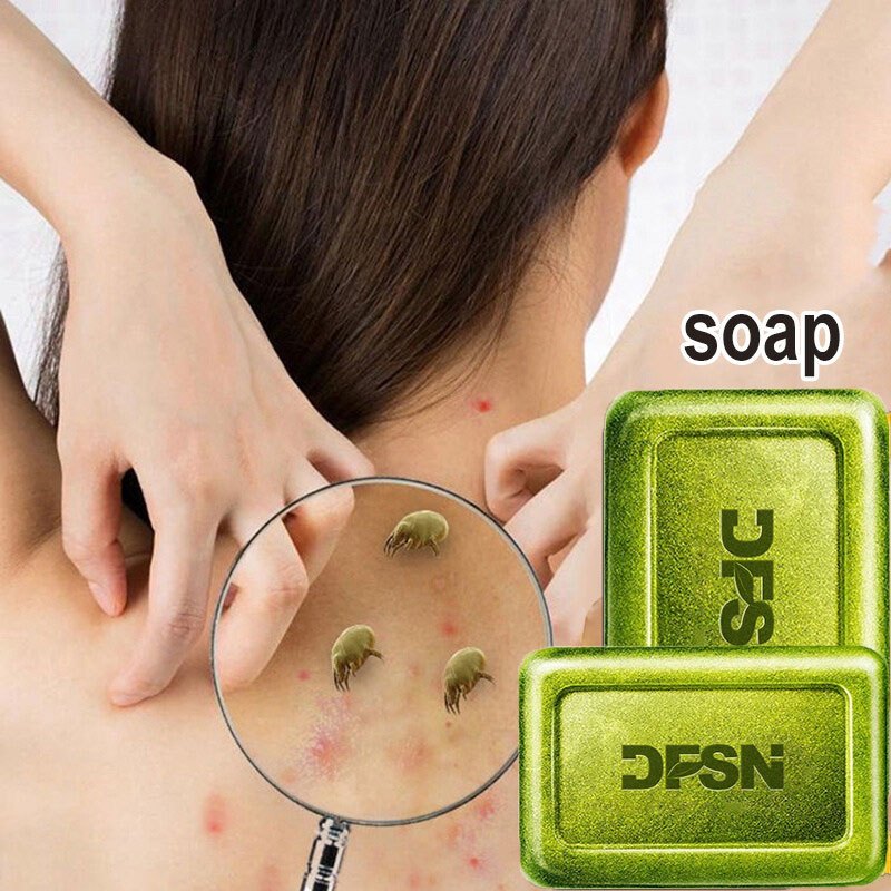 soap - sulfur soap - sabun gatal kulit 110g 硫磺皂 Mugwort essence ...