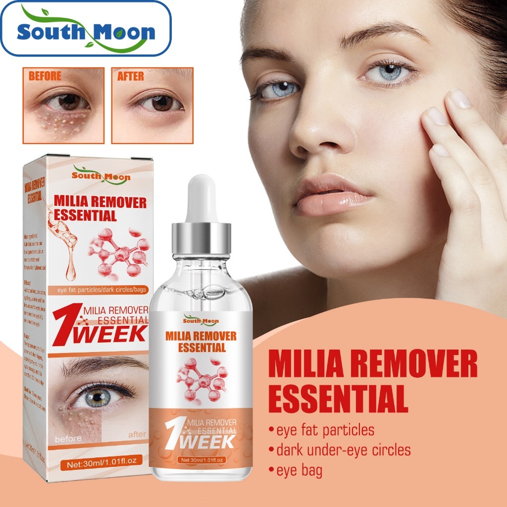 30ml Milia Remover Essential Fat Granules Removing Serum Remove Eye Fat ...