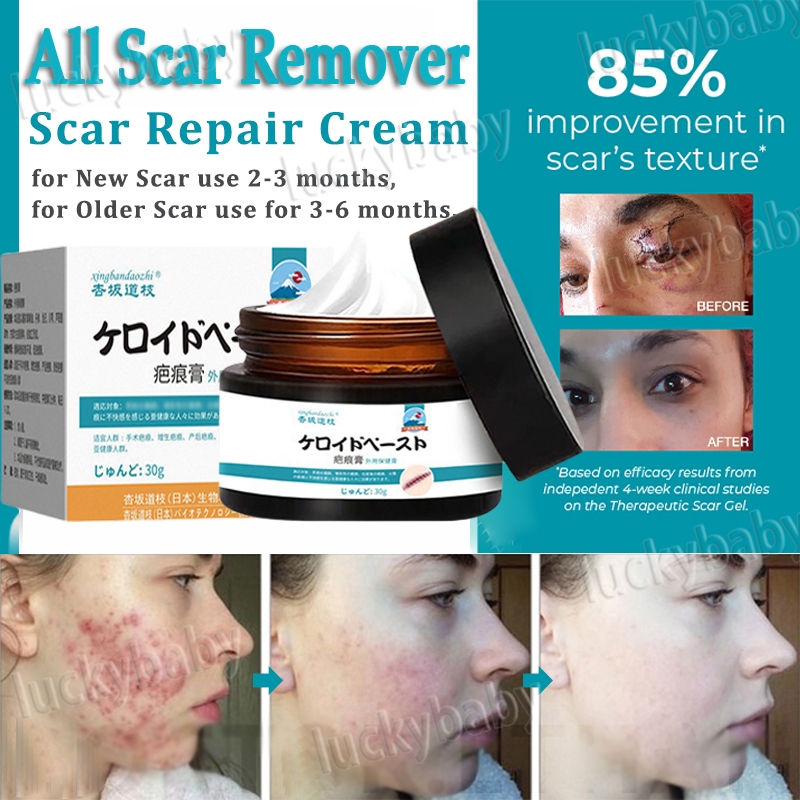 Japan Scar Removal Cream Repair old scars Scald Scar Insect Bite Scar ...