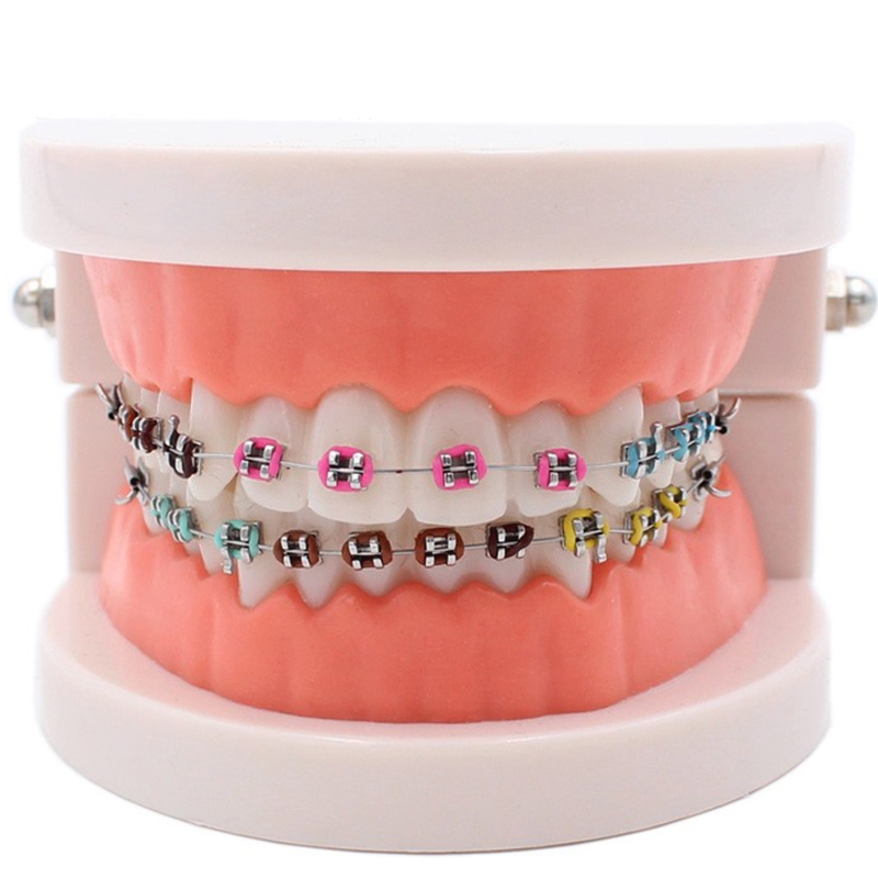 Dental Teach Study Orthodontic Tooth Teeth Model with Metal Brackets ...