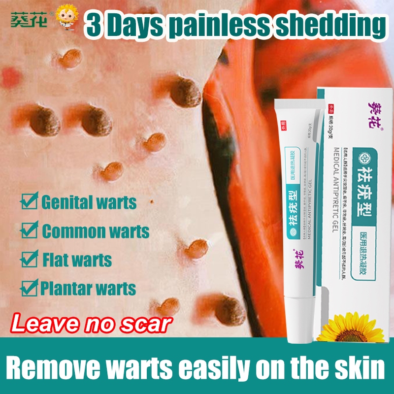 Pain-free Warts Removal Cream Wart Remover Ubat ketuat kutil tahi lalat ...