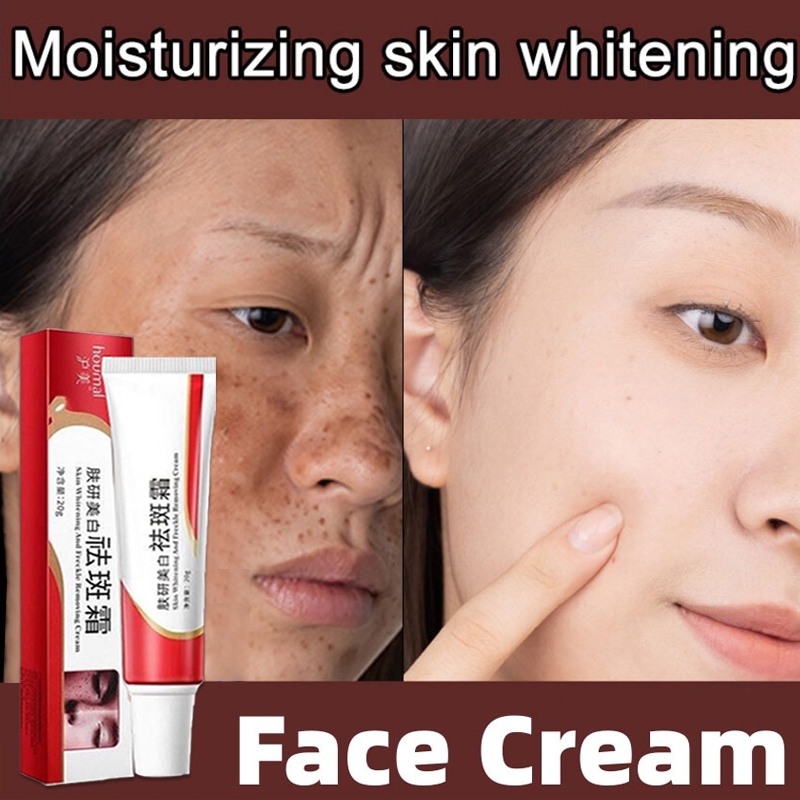 Freckle cream Dark spot serum美白祛斑霜 Whitening and moisturizing Remove ...
