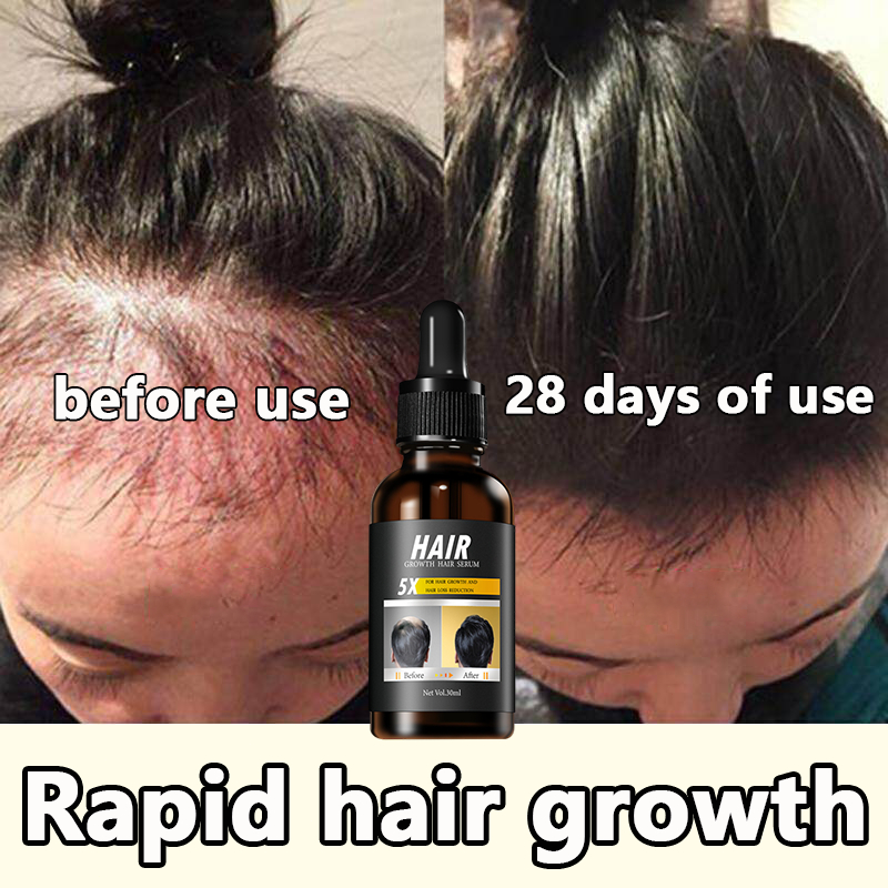 Hair Growth Serum Serum penumbuh rambut Anti hair loss serum 30ml ...