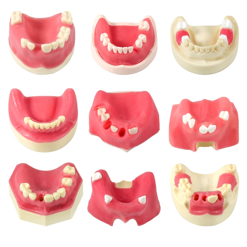 Dental Implant Practice Model Mandibular/maxillary sinus With Soft Gums ...