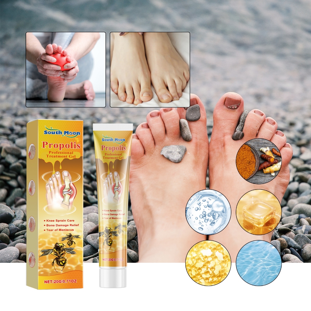 Bee Venom Analgesic Cream Bunion Pain Relief Treat Hallux Valgus Gout ...