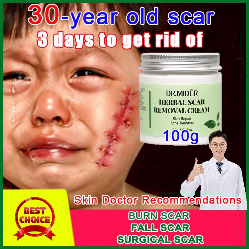 【No effect full refund】100g scar removal cream scar cream scar gel krim hilangkan parut hitam ...
