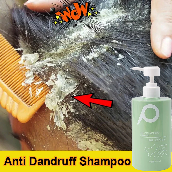 Dandruff Shampoo 500ml Treat Psoriasis Scalp Amino acid Anti-Dandruff Oil Control Nourish Hair ...