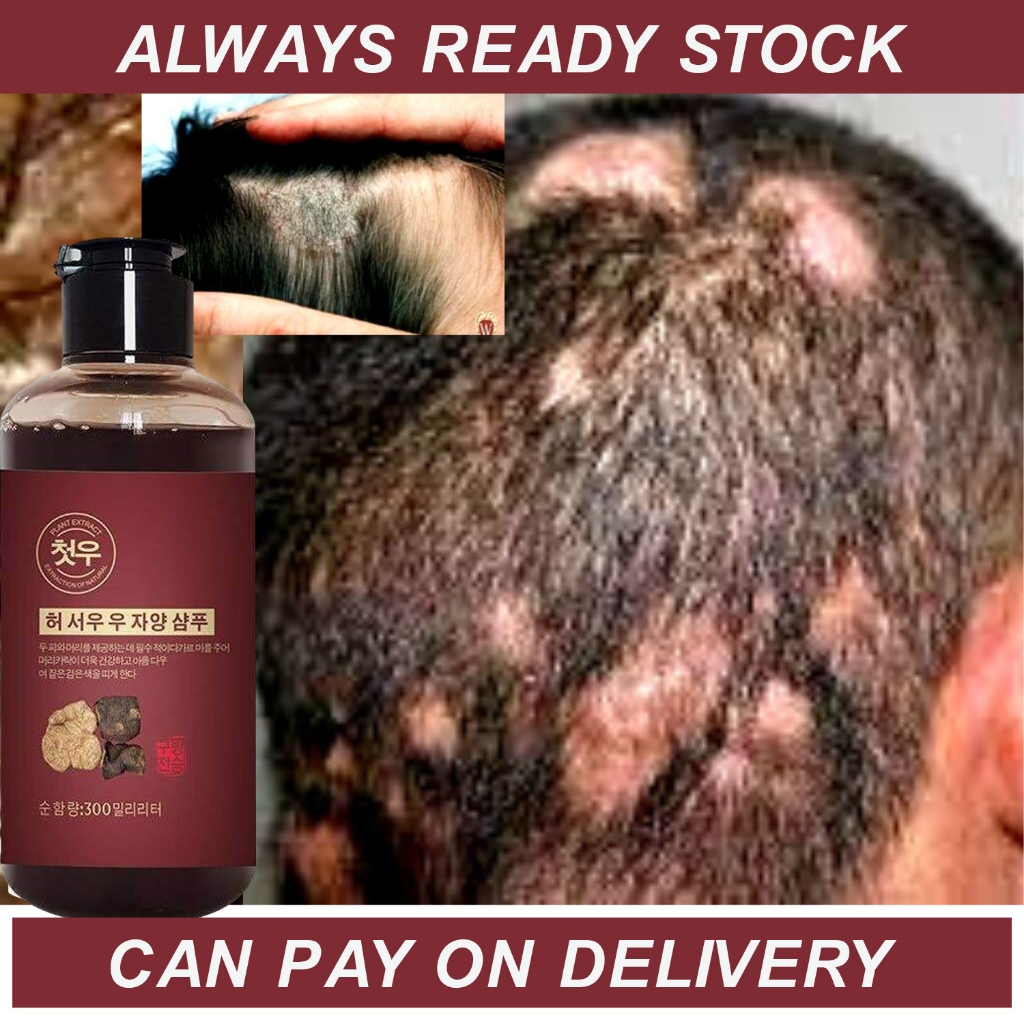 Polygonum multiflorum Hair Growth white to black shampoo/Anti-dandruff ...