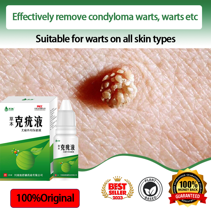 Wart Removal【Hot sale】Wart Removal Buang Kutil Corn and Calluse Remover ...