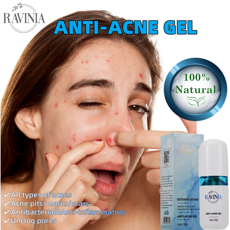 RAVINIA Acne gel 30g krim jeragat acne scar removal Pimple Repair Skin ...