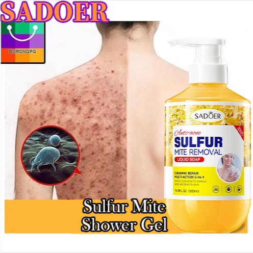 Shower Gel Anti-mite Dust mite body wash Natural bed bug and dust mite ...