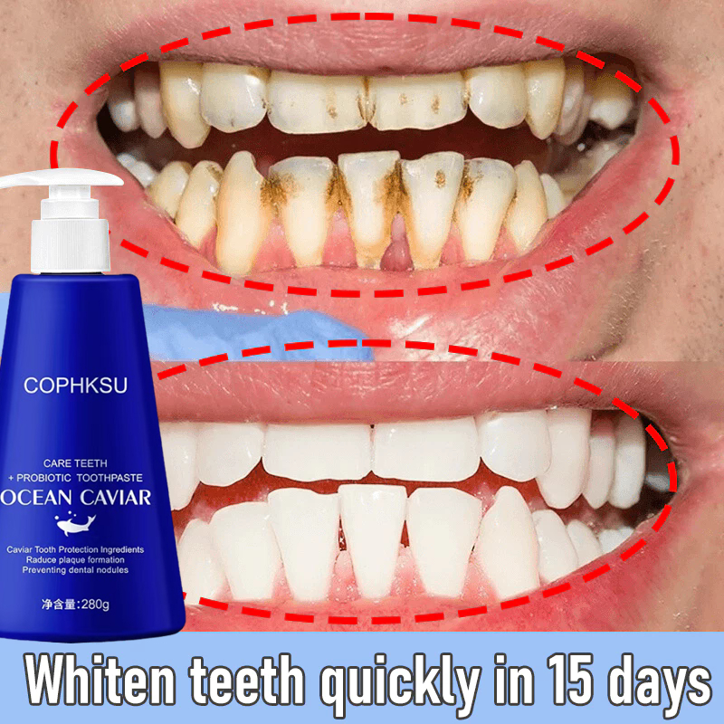 COPHKSU Probiotic Toothpaste teeth whitening removes plaque and tartar ...