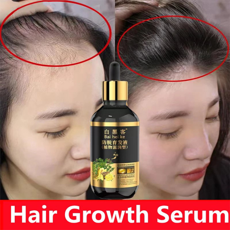 Ancient traditional Chinese medicine prescription.Hair Growth Serum ...