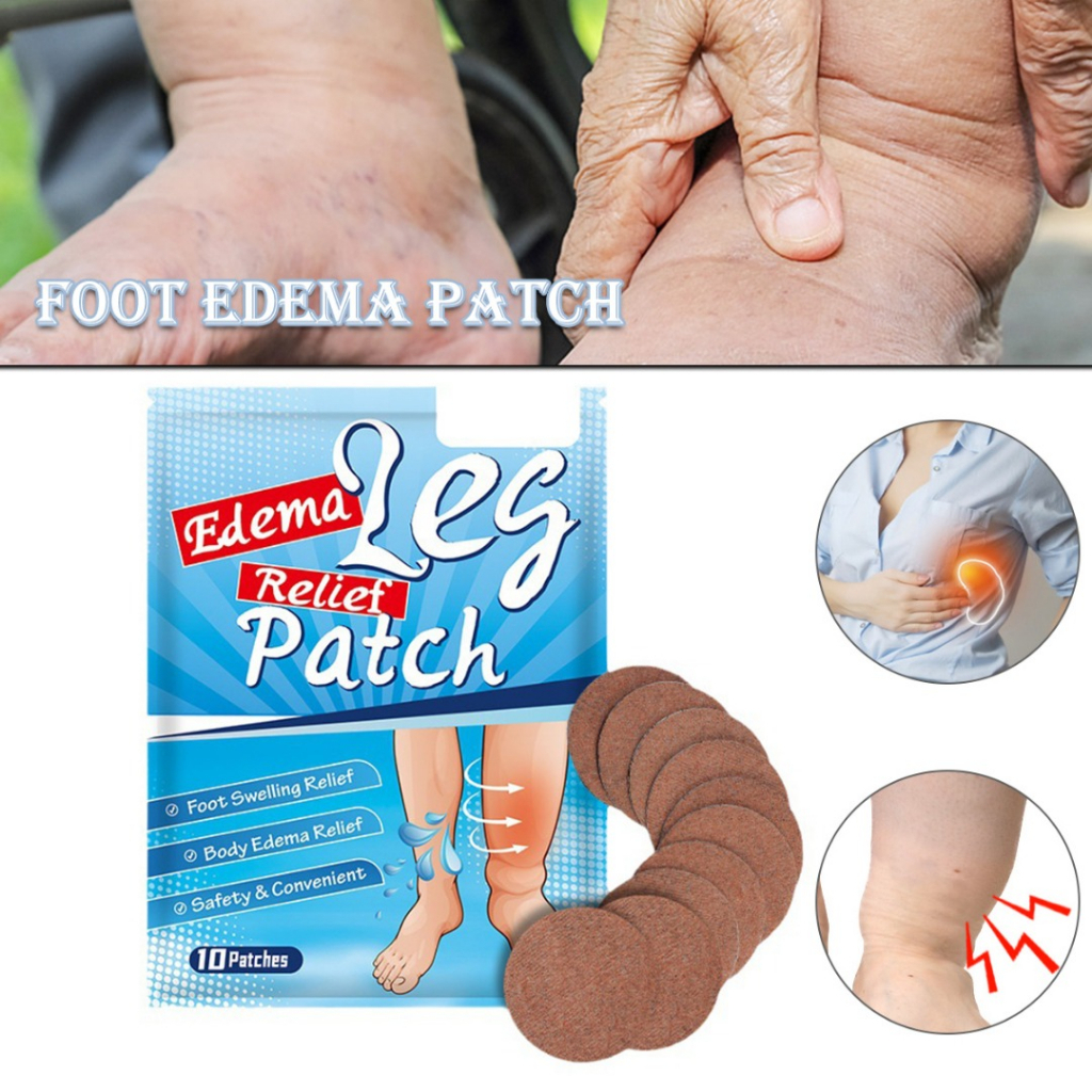 In stock & 10pcs Edema Leg Relief Patch Leg swelling and foot care ...