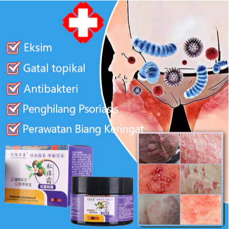 cream gatal kulit eczema cream krim gatal kulit krim gatal kulit herba ...
