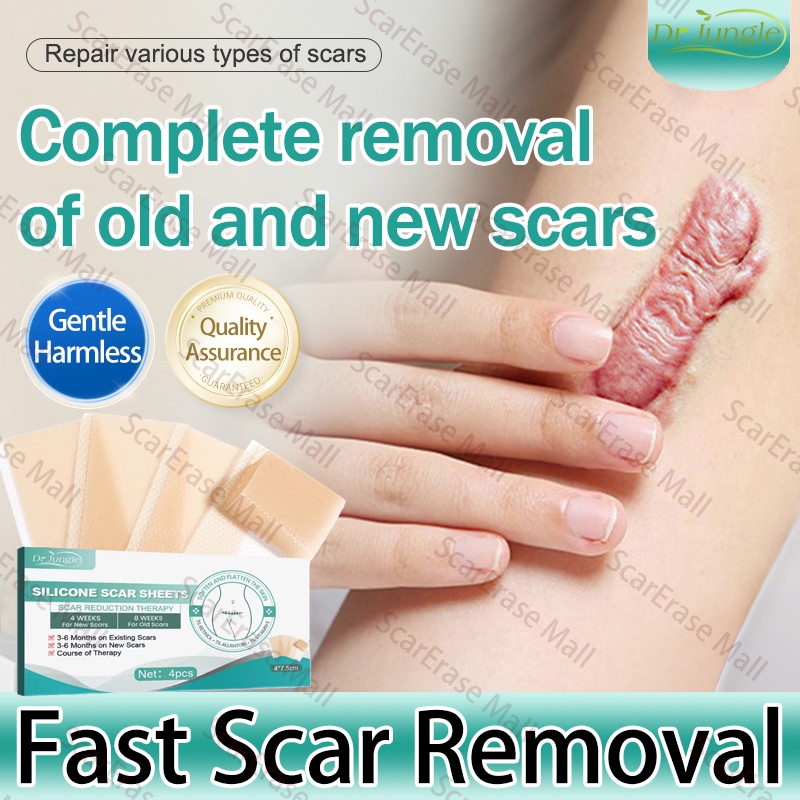 🔥TOP 1🔥 scar patch waterproofEfficient Surgery Scar Removal4x7.5cm ...