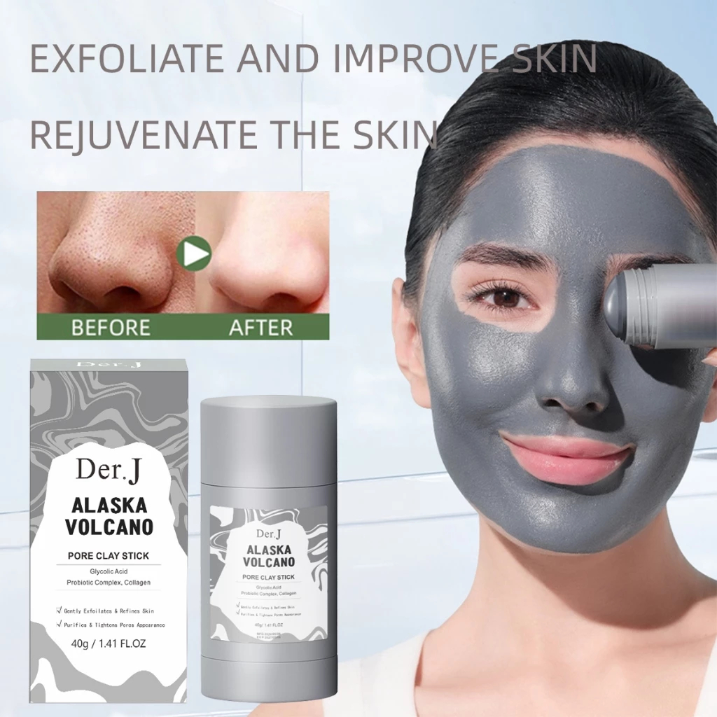 【READY STOCK】New Acne clay mask Clay Mask Cleanses Oil Control Anti ...