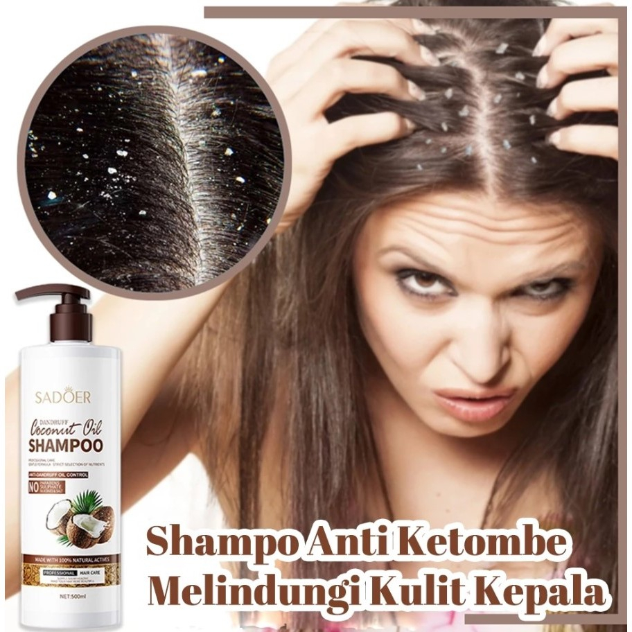 SADOER Anti-dandruff Shampoo Coconut Oil Shampoo Kelemumur Control Anti Itching Scalp Treatment ...
