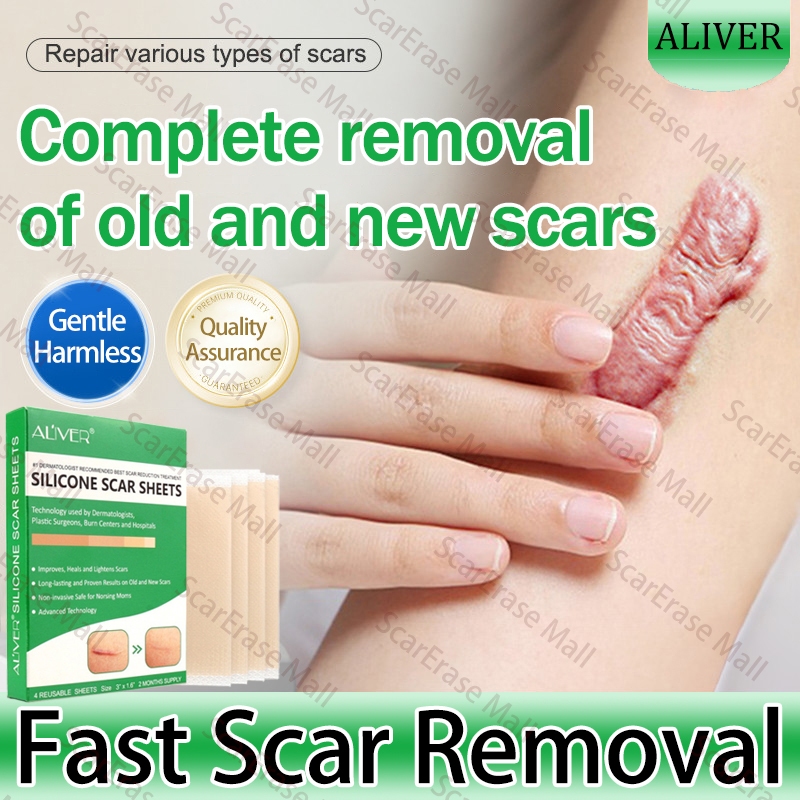 🔥Hot Sale🔥aliver scar removal patch scar repair Safe and painless ...