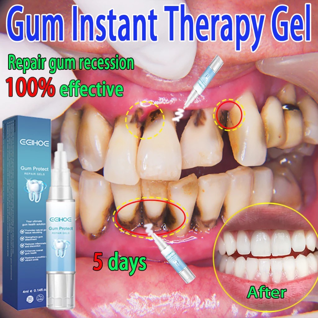 Gum Instant Soothing Gel Receding Gums Treatment Tooth loosening ...