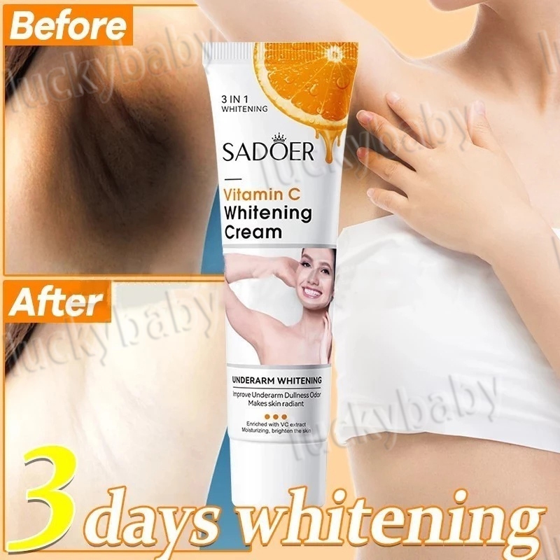 SADOER Vitamin C Underarm Whitening Cream Private Parts Whitening Improve Dull Remove Dark Spots ...
