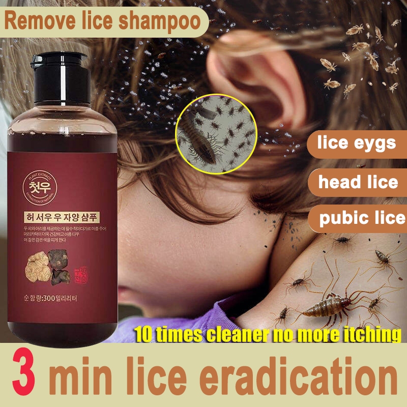 Shampoo kutu rambut ubat kutu rambut manusia Children and adults lice ...