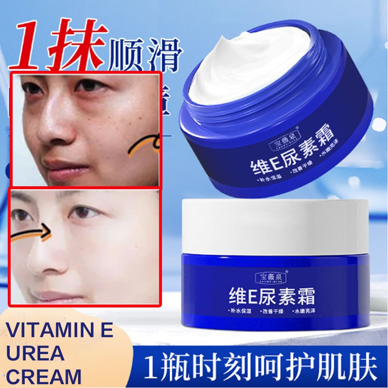 [COD] Yellow Spots Disappear Spot Fading Vitamin E Urea Cream Hydrating Blemish Essence Improve ...