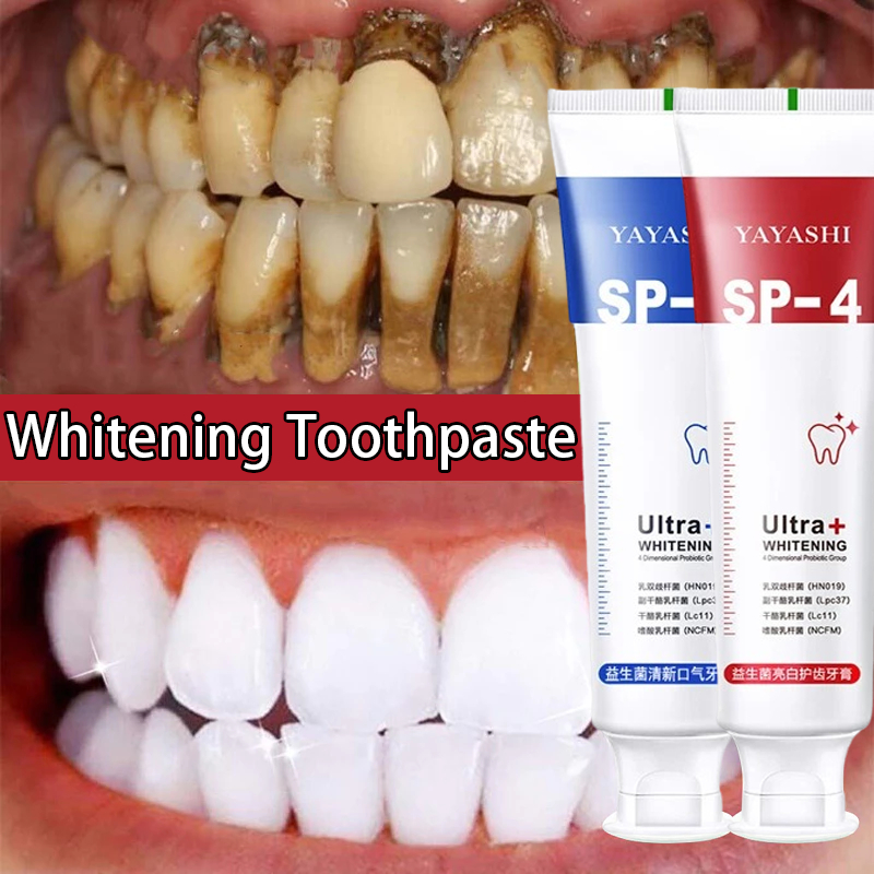 teeth sp4 whitening 120g pemutih gigi yatai probiotic toothpaste oralShark original whitening ...