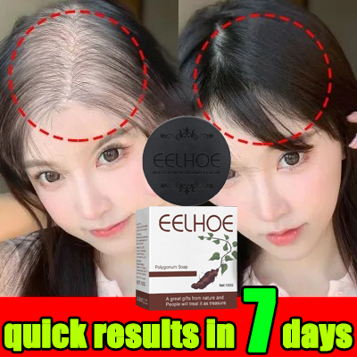 Local delivery Hair growth soap: prevent hair loss and grow hair ...